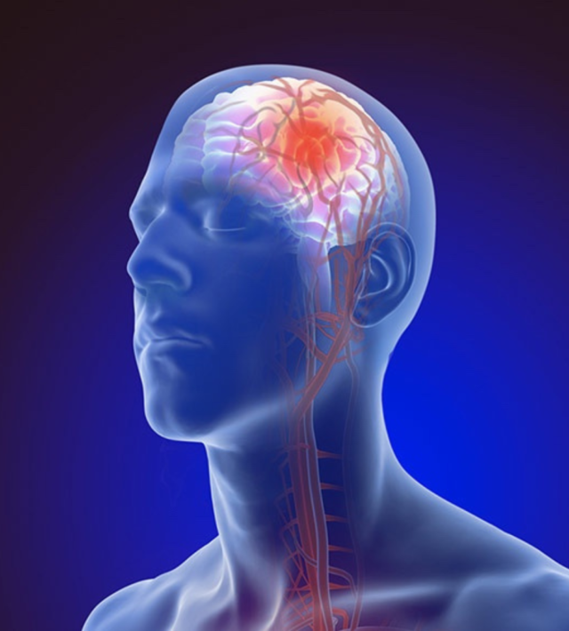 Public information - strokeindia